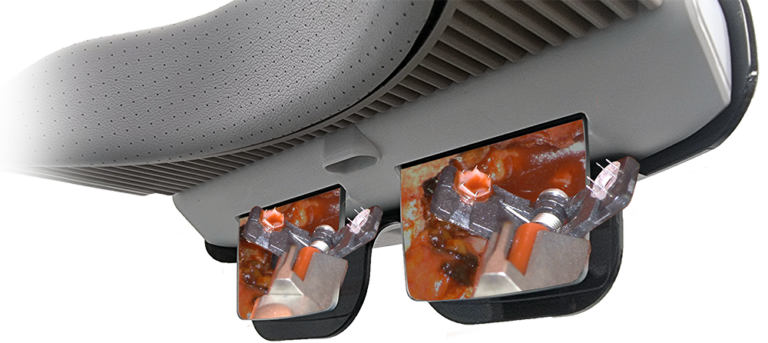 3D SCOPEYE Solution - MediThinQ