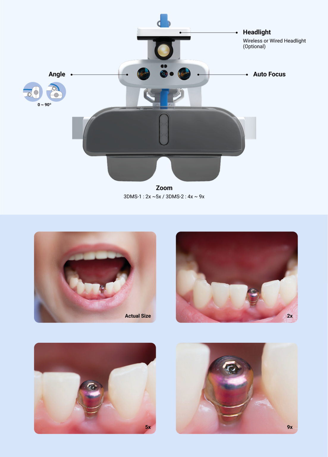3D MetaSCOPE - MediThinQ