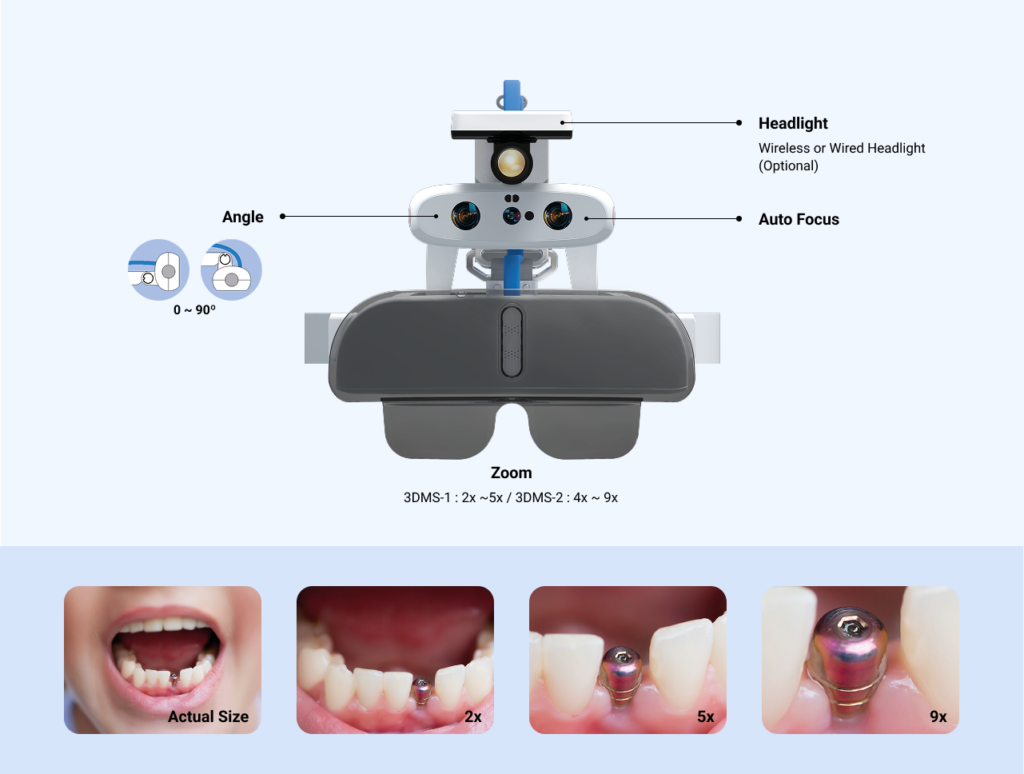 3D MetaSCOPE - MediThinQ